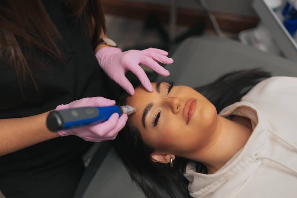 Skin Resurfacing With Microneedling OKC - SkinPen Treatment